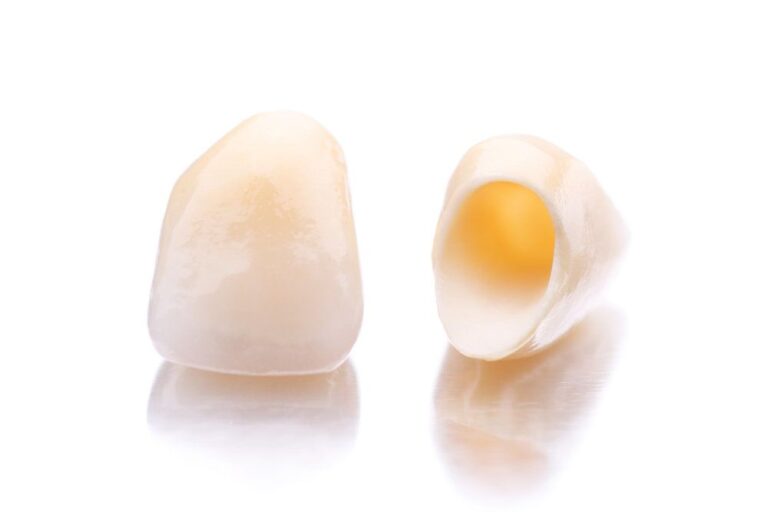 Tooth Sensitivity after Dental Crown Treatment